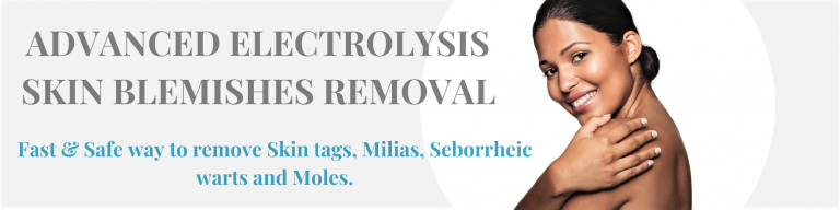 Electrolysis Skin Blemishes Removal I Prima Britannia Laser Clinic